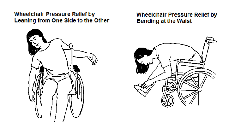 Bed positioning for pressure relief - Rolstoel